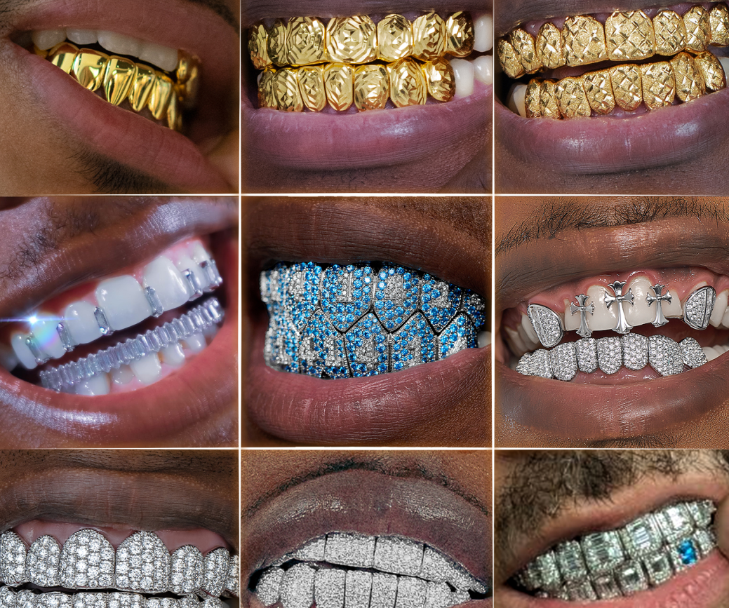 Brass Grillz Set – ICEGIANT