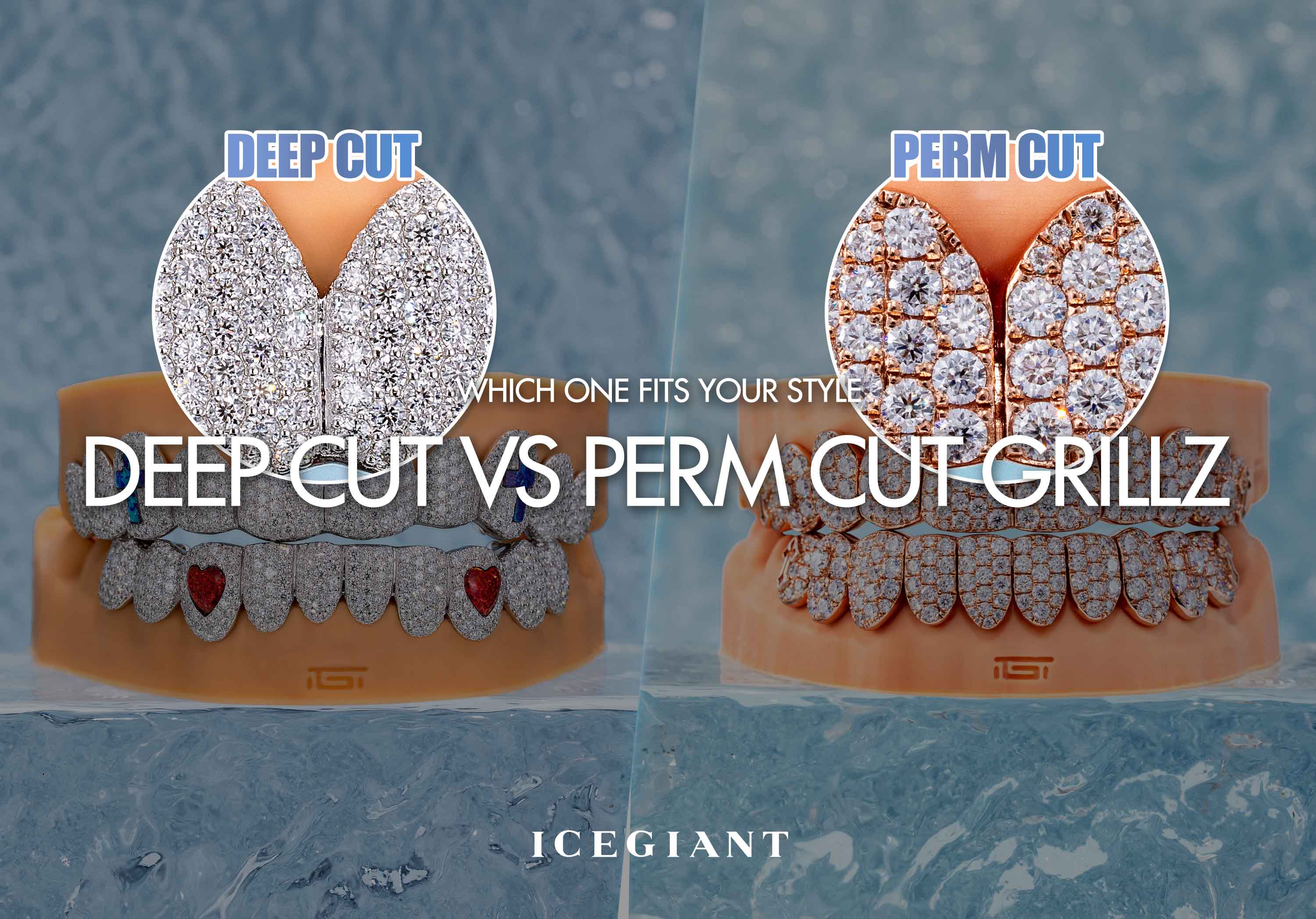 Deep Cut vs Perm Cut Grillz – Which Style Fits You? – ICEGIANT