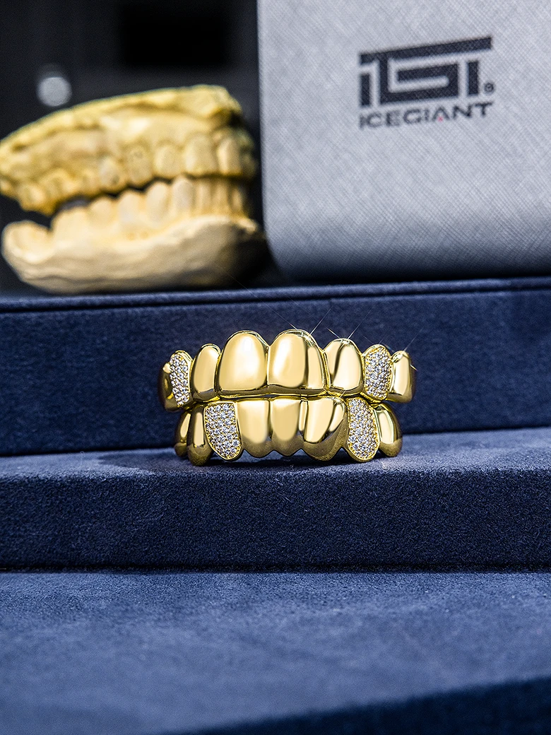 CUSTOM POLISHED GOLD & DIAMOND GRILLZ – ICEGIANT
