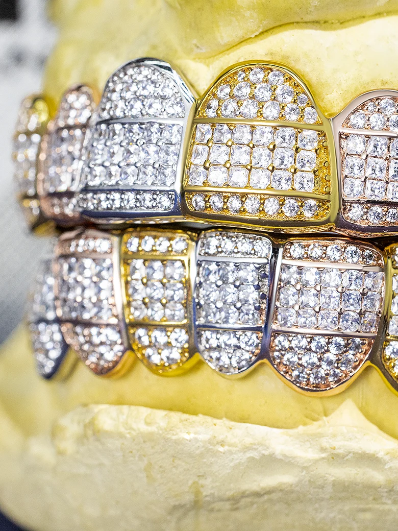 CUSTOM TRI-COLORED DIAMOND GRILLZ – ICEGIANT