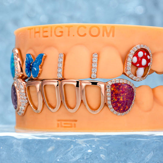 Custom Open Face Grillz - Gold Window Teeth Sets | ICEGIANT