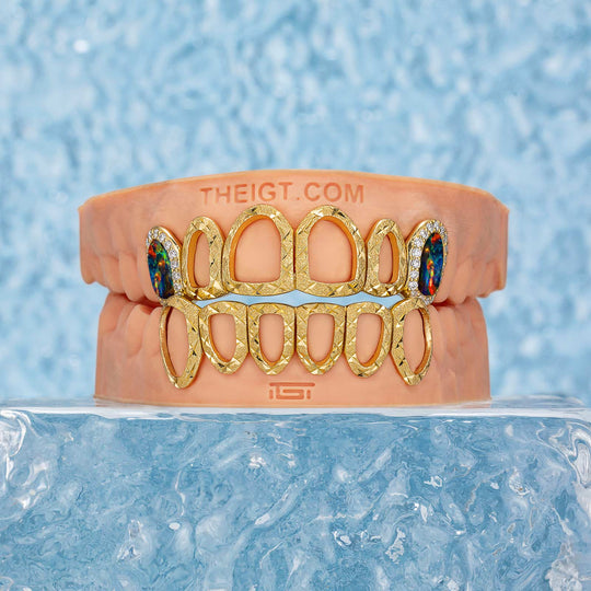 Women's Custom Grillz | Dainty Moissanite, Rose Gold & Opal | IGT ...