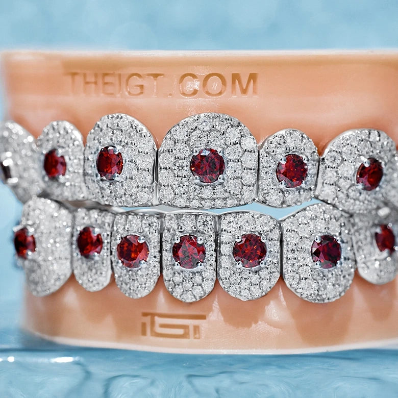 Custom Rimless Set Red Gemstone Grillz – ICEGIANT