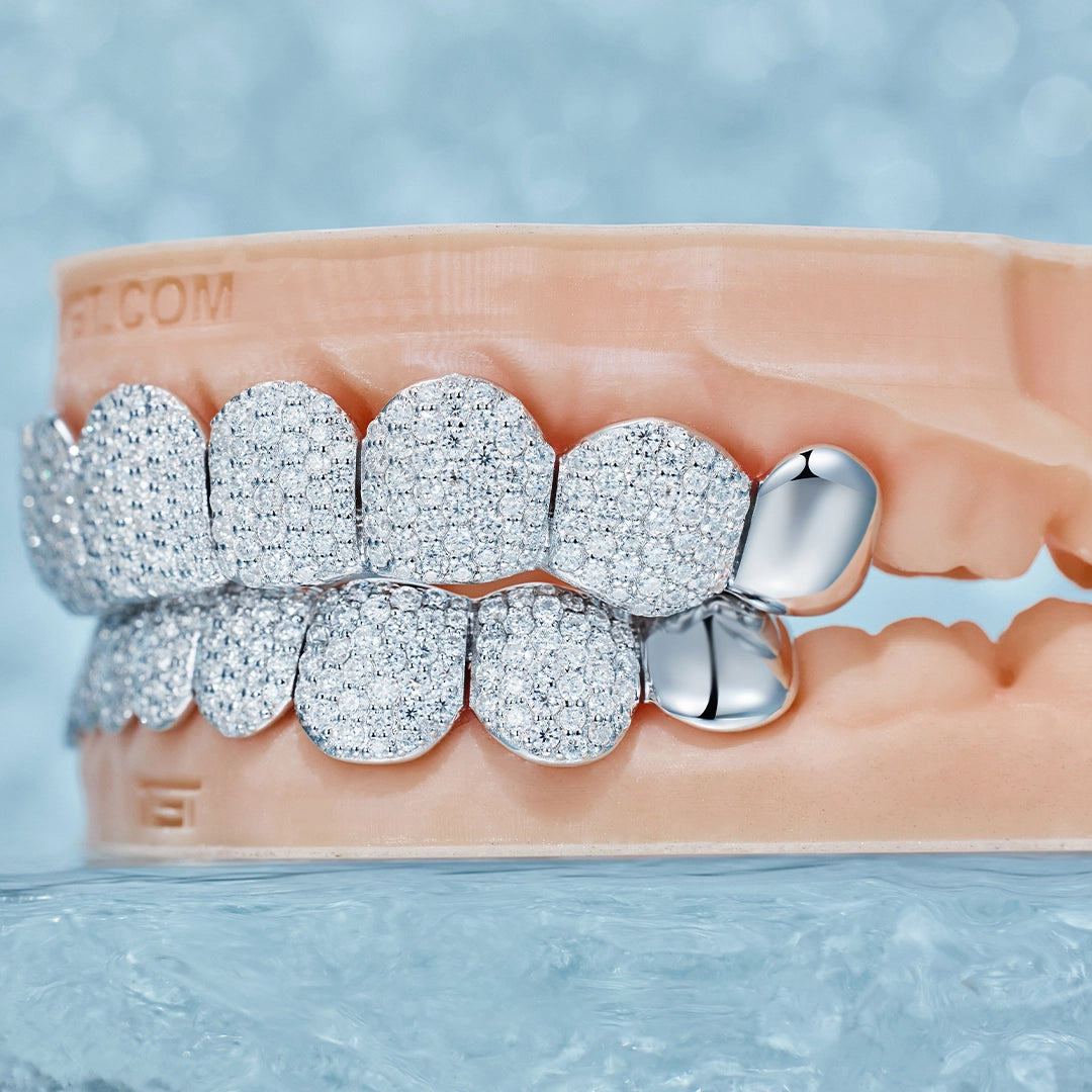 Custom End Capped Moissanite Grillz – ICEGIANT