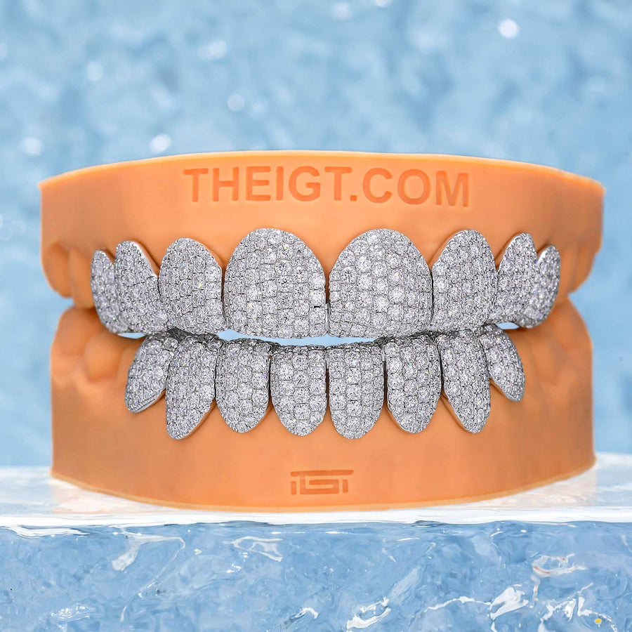 Custom Diamond Grillz - 925 silver & VVS Clarity Sets | ICEGIANT