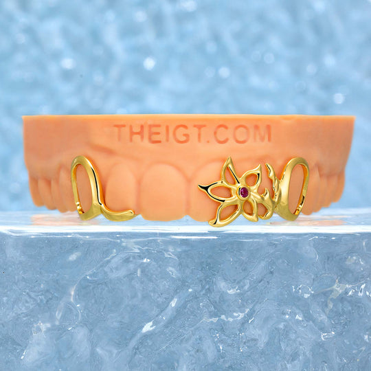 Custom Open Face Grillz - Gold Window Teeth Sets | ICEGIANT