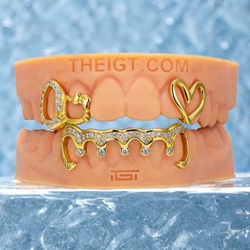 Custom Open Face Grillz - Gold Window Teeth Sets | ICEGIANT