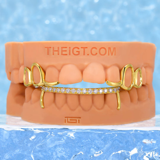 Custom Open Face Grillz - Gold Window Teeth Sets | ICEGIANT