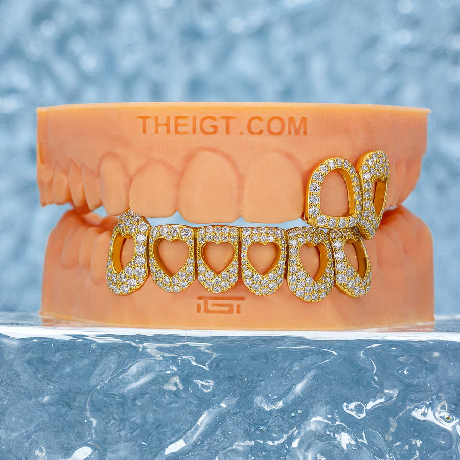 Custom Open Face Grillz - Gold Window Teeth Sets | ICEGIANT