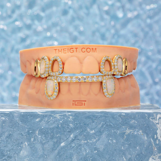 Custom Open Face Grillz - Gold Window Teeth Sets | ICEGIANT