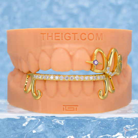 Custom Grillz – ICEGIANT