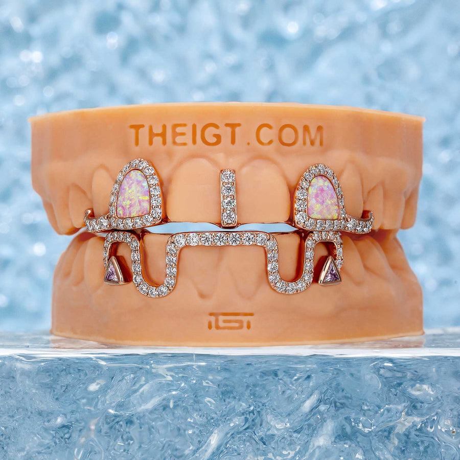 Custom Bar Grillz - Sleek Gold Teeth Bar Sets | ICEGIANT