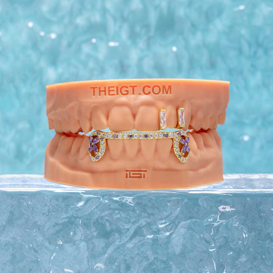 Women's Custom Grillz | Dainty Moissanite, Rose Gold & Opal | IGT ...